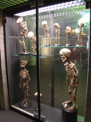 “Where are your gibes now?” Preserving Humanity in the Museum Vrolik ...